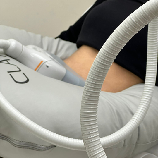 TC Cryo vet bevriezen - Medi Skin Care